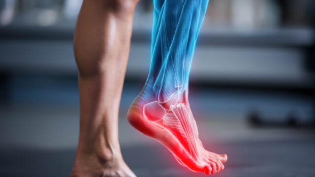 Ankle Sprain Rehab- Why Balance Prevents Chronic Instability